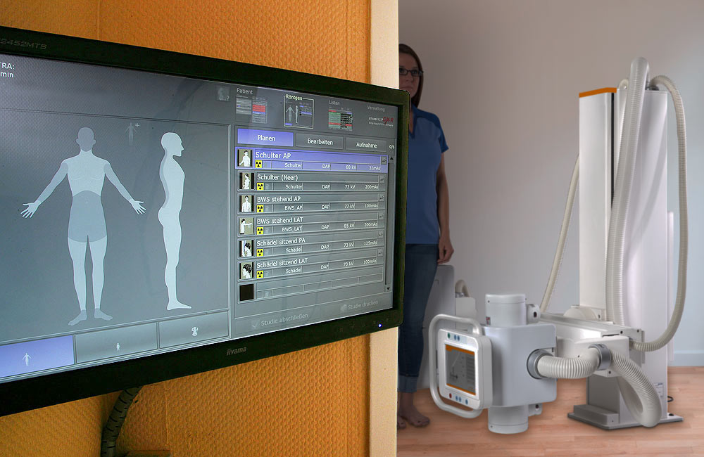 Digital X-ray with motorised U-arm system