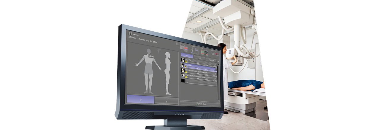 Digital X-ray | acquisition and diagnostic software