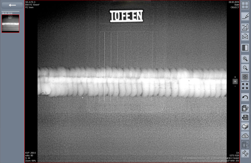 DICONDE-Cloud NDT | Archiving X-ray images