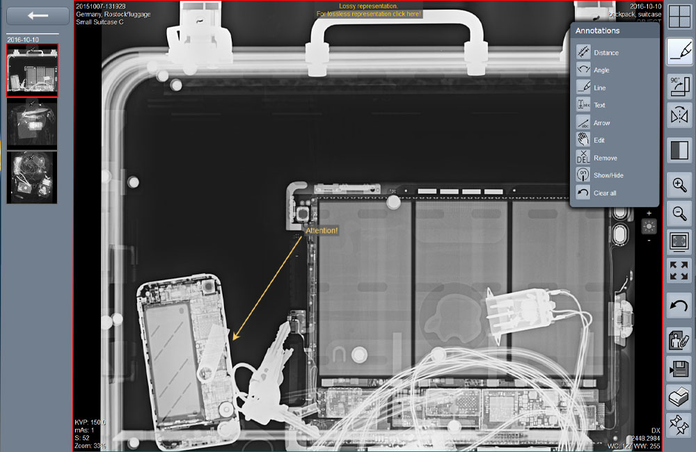 DICOS Cloud Security IOD/EOD | Archiving X-ray images