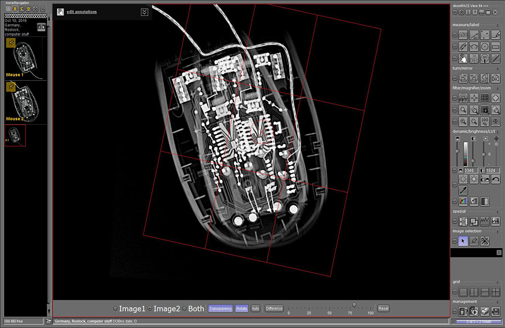 digital image management for radiographic inspection (RT) NDT