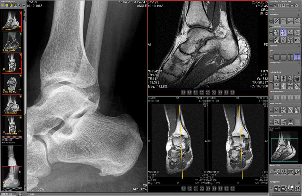 PACS software | image management for practice and hospital