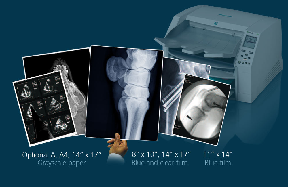 All-in-one imager for vets / film printer for X-ray films without chemistry